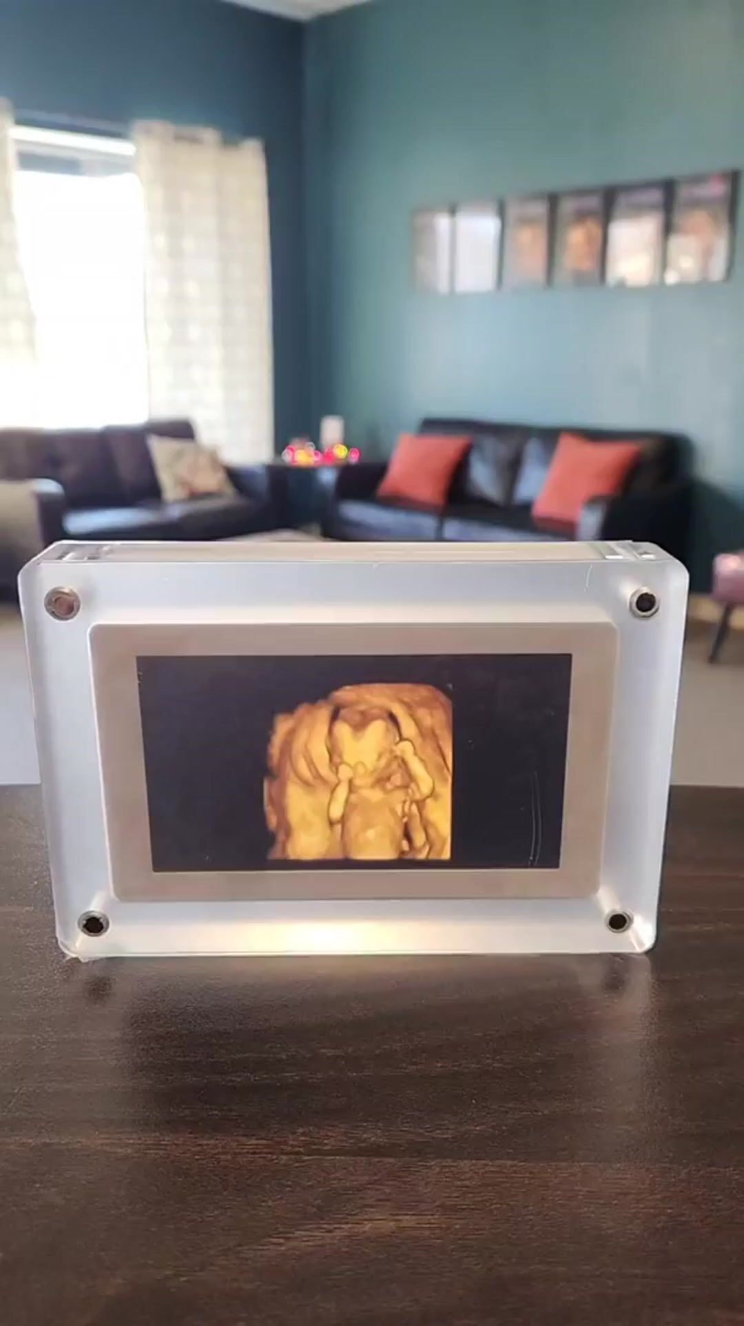 3D/4D & HD Ultrasounds | Sneak Peek 3D